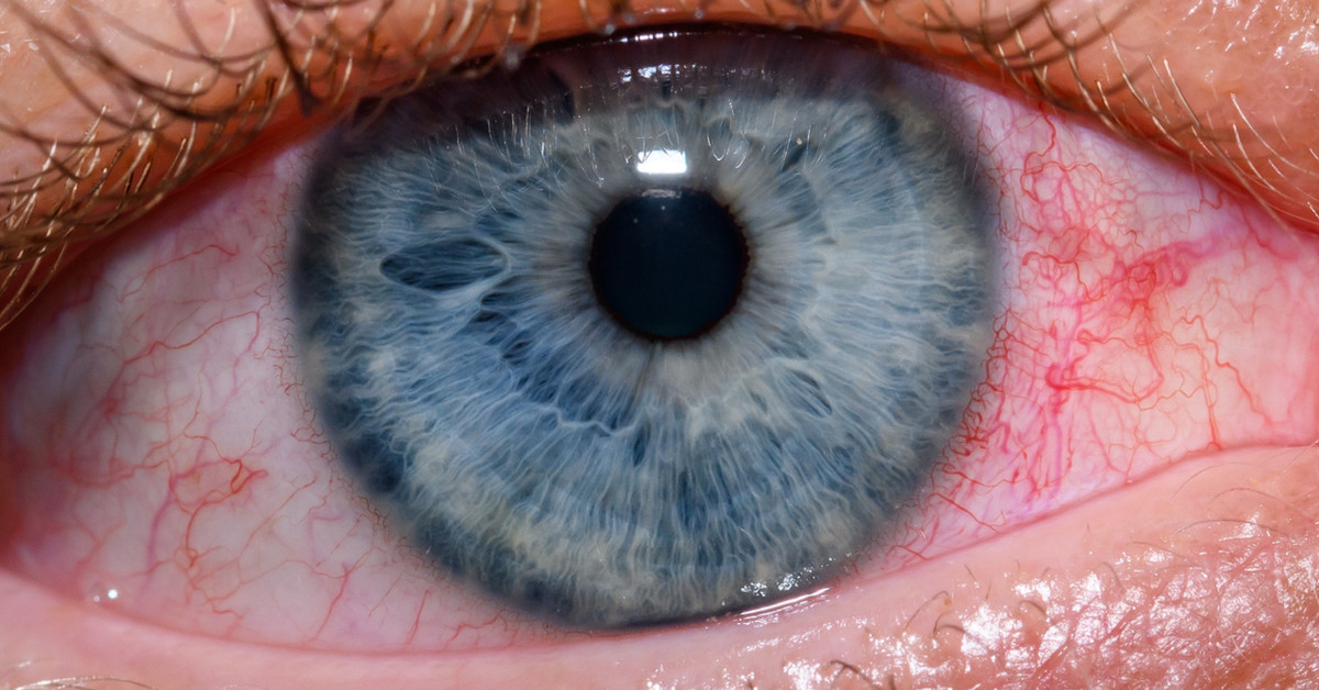 The Red Eye - Podcast